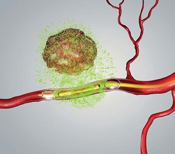 RenovoRx Announces Acceptance of Clinical Data Abstract at 2026 Society ...