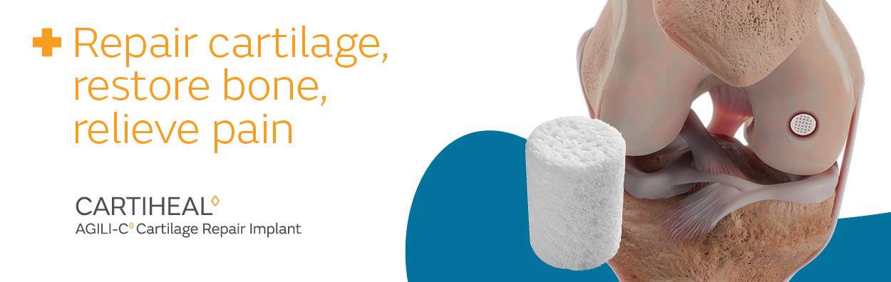 New data for Smith+Nephew’s CARTIHEAL AGILI-C Cartilage Repair Implant ...